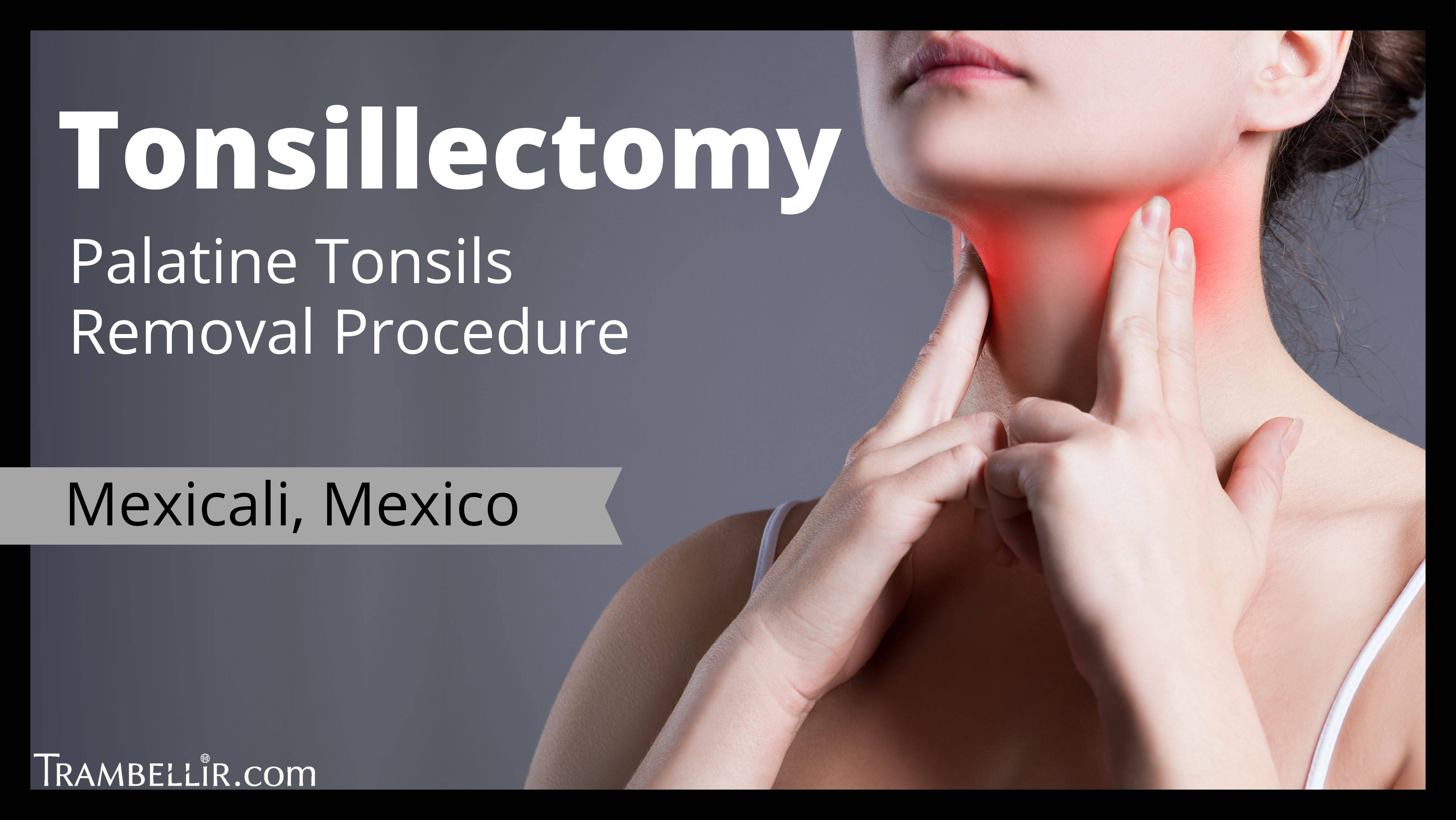 Tonsillectomy (Palatine Tonsils Removal Procedure) | Trambellir