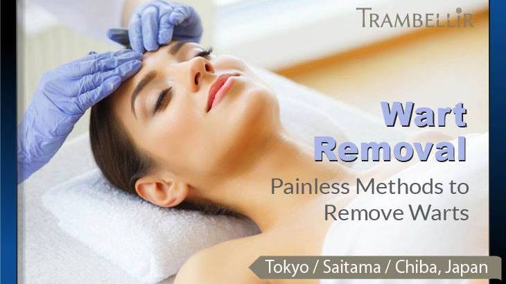 Wart Removal (Painless Methods to Remove Warts) [Chiba] | Trambellir