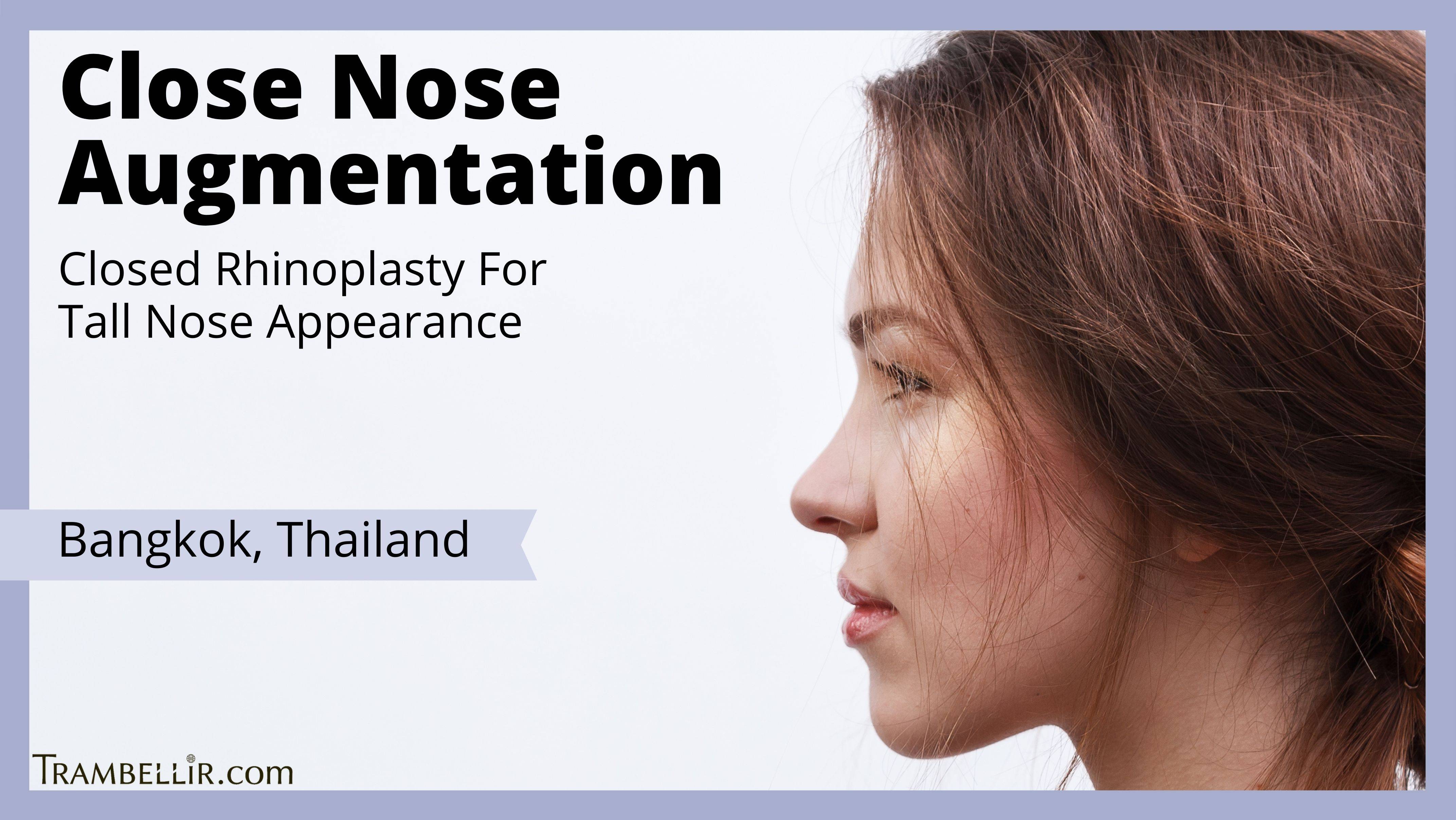 Close Nose Augmentation (Closed Rhinoplasty For Tall Nose Appearance ...