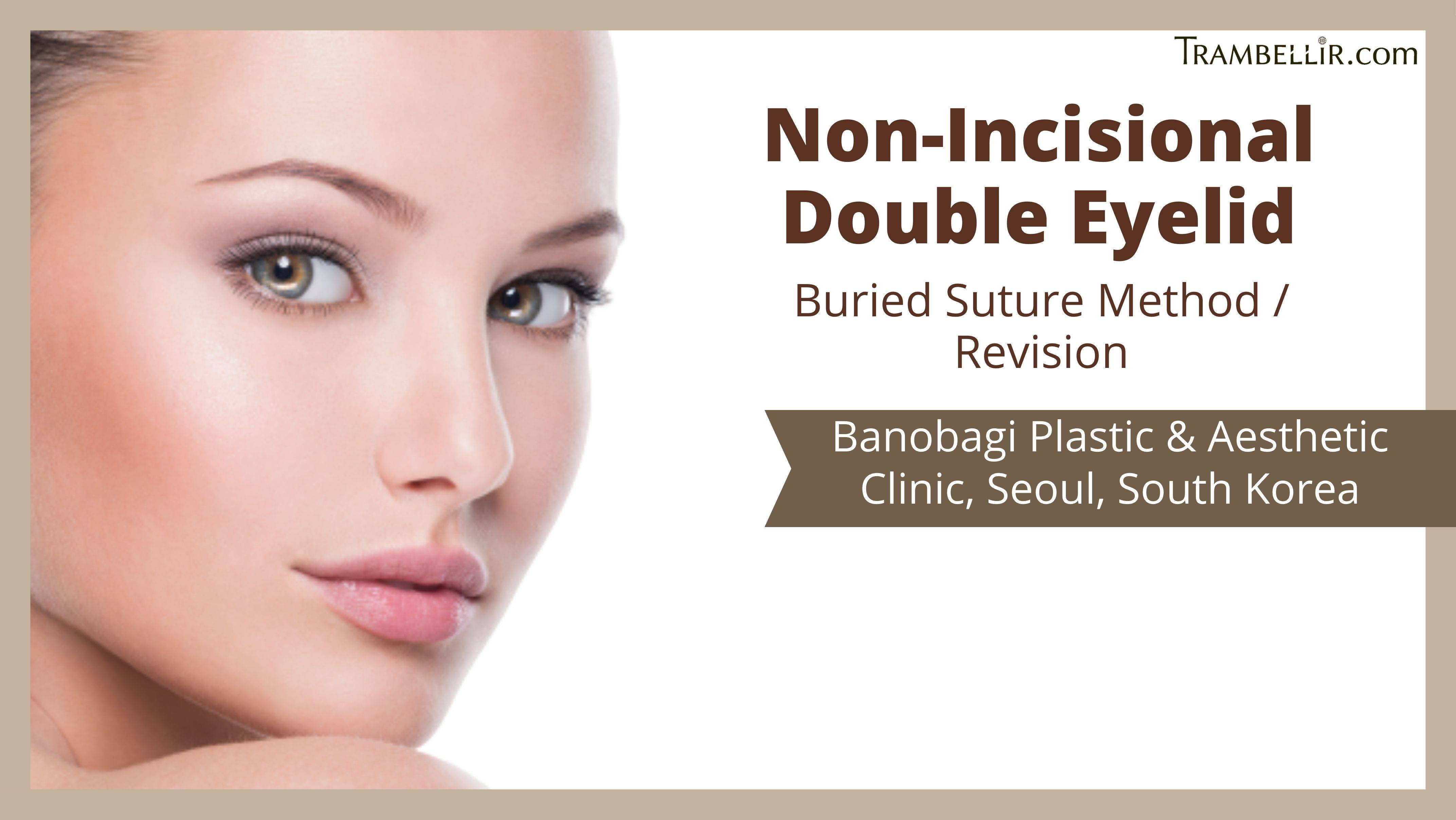 Non-Incisional Double Eyelid (Buried Suture Method / Revision) | Trambellir