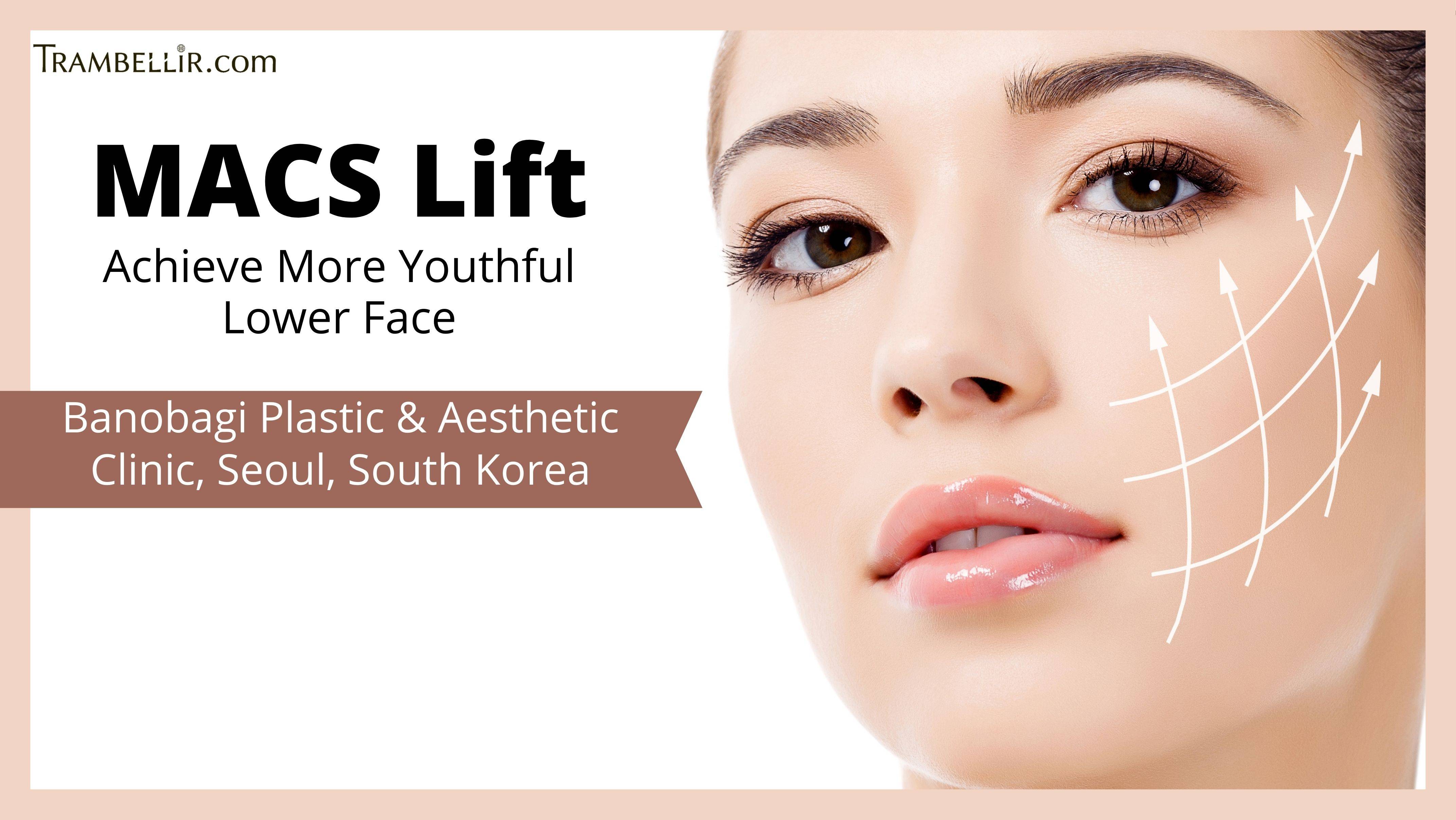 MACS Lift (Achieve More Youthful Lower Face) | Trambellir