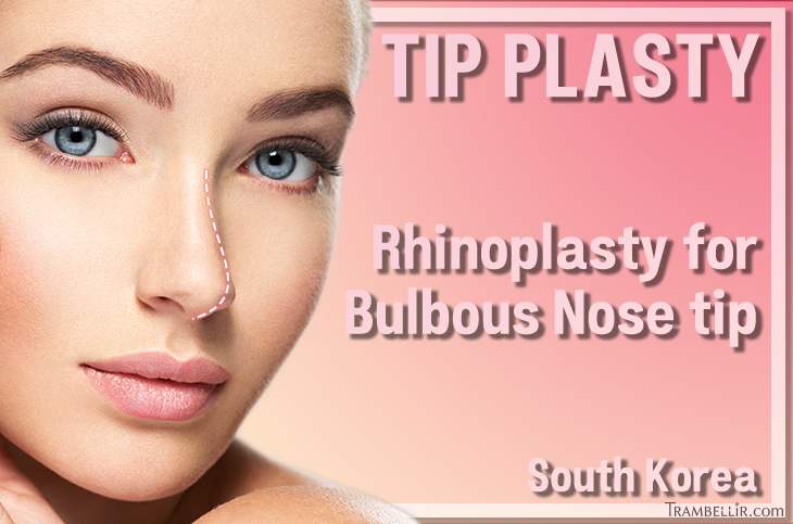 Tip Plasty (Rhinoplasty for Bulbous Nose Tip) | Trambellir