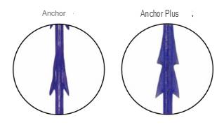 Anchor Plus Lift (Face Line Lifting using Thread Lift) | Trambellir