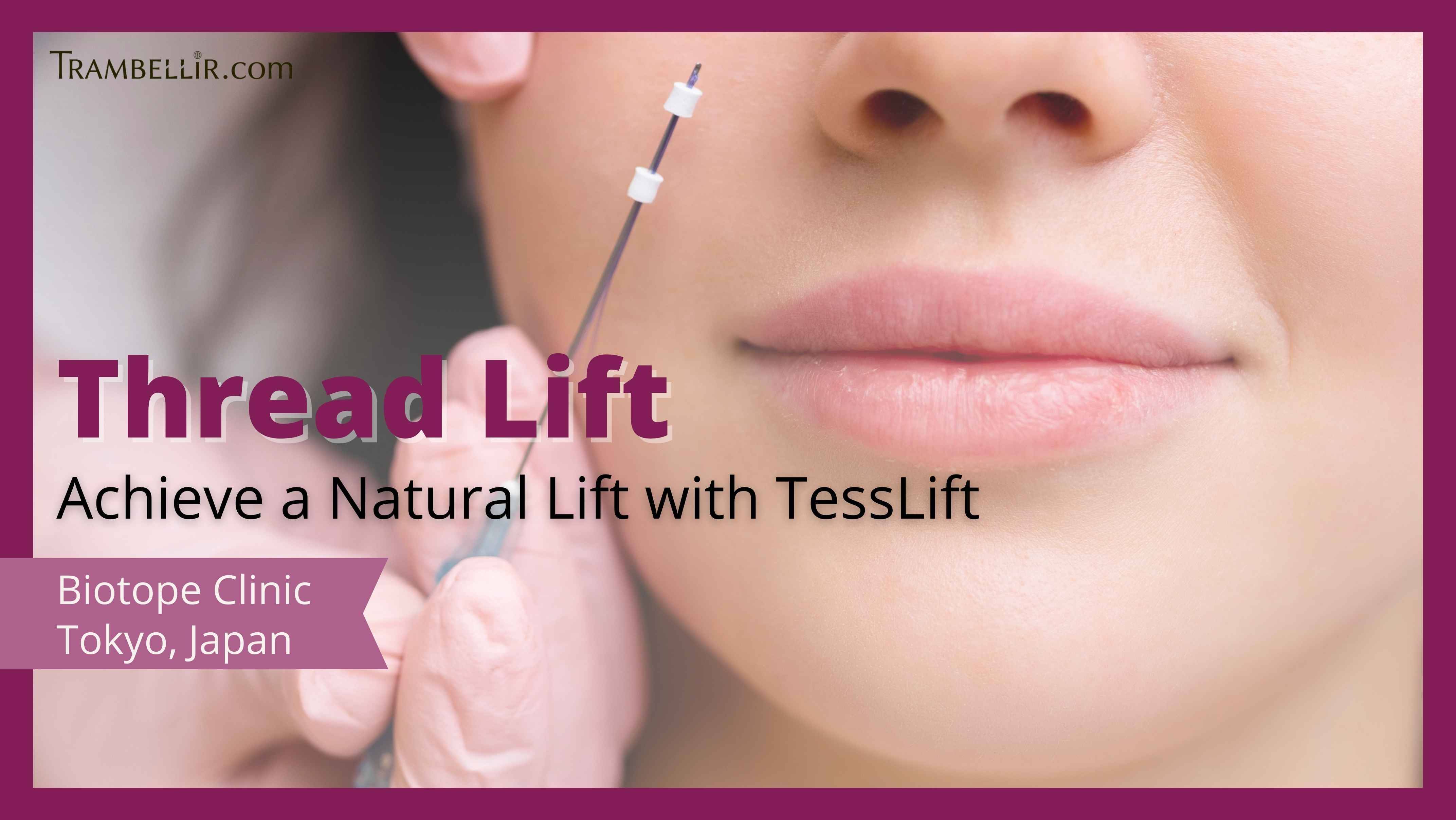 Thread Lift (Achieve A Natural Lift With Tesslift) | Trambellir