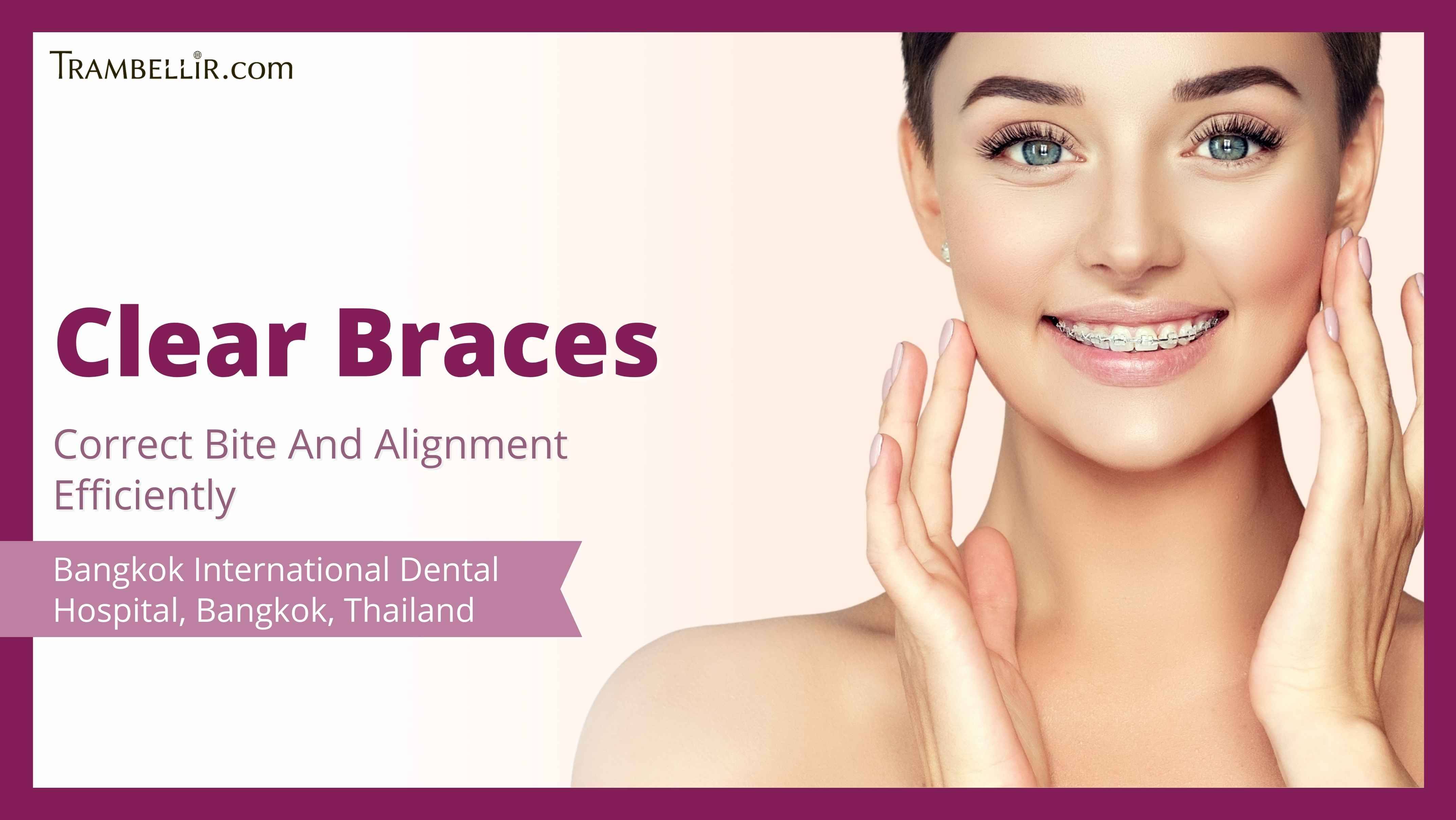 Clear Braces (Correct Bite And Alignment Efficiently) | Trambellir