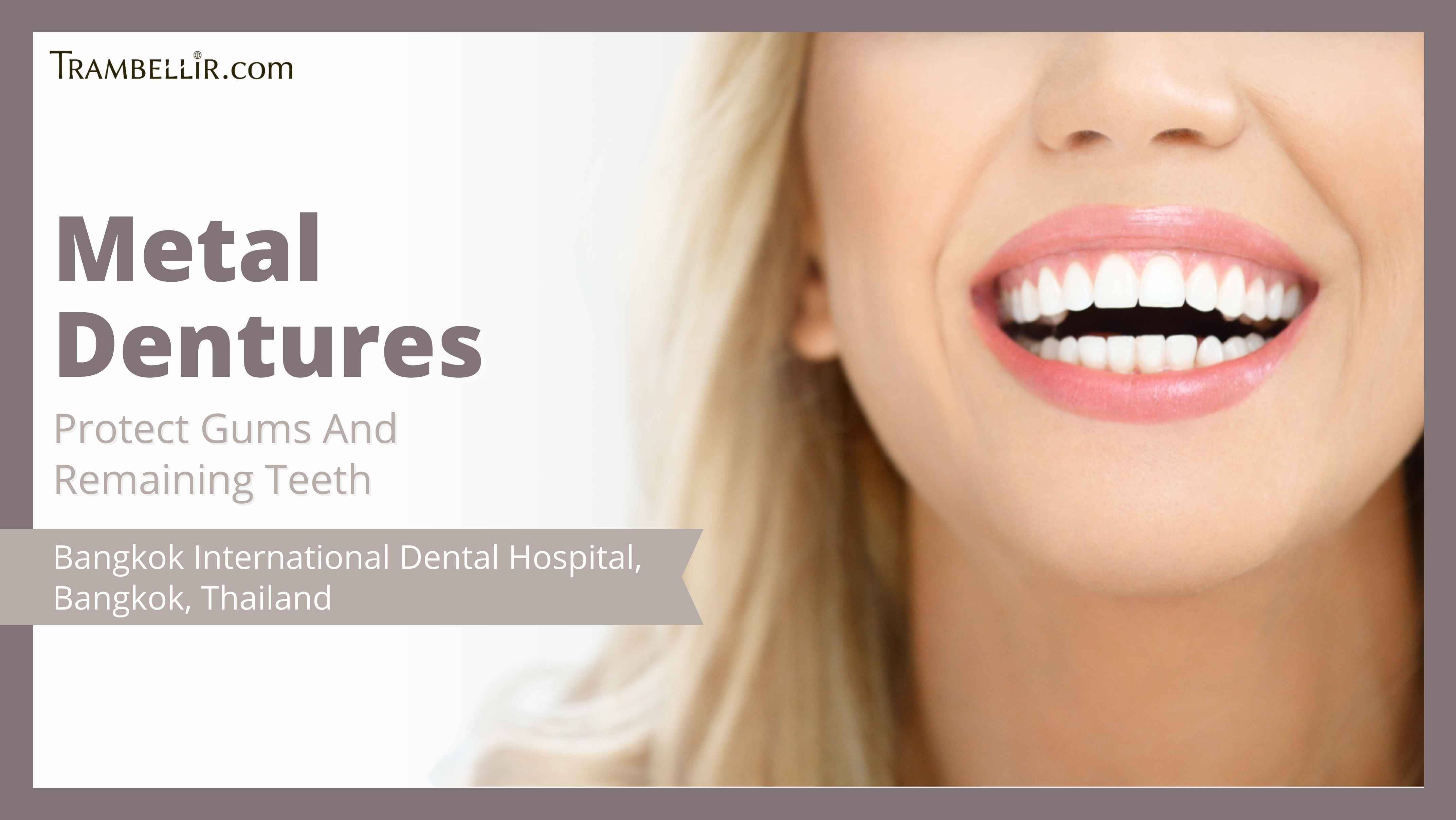 Metal Dentures (Protect Gums And Remaining Teeth) | Trambellir