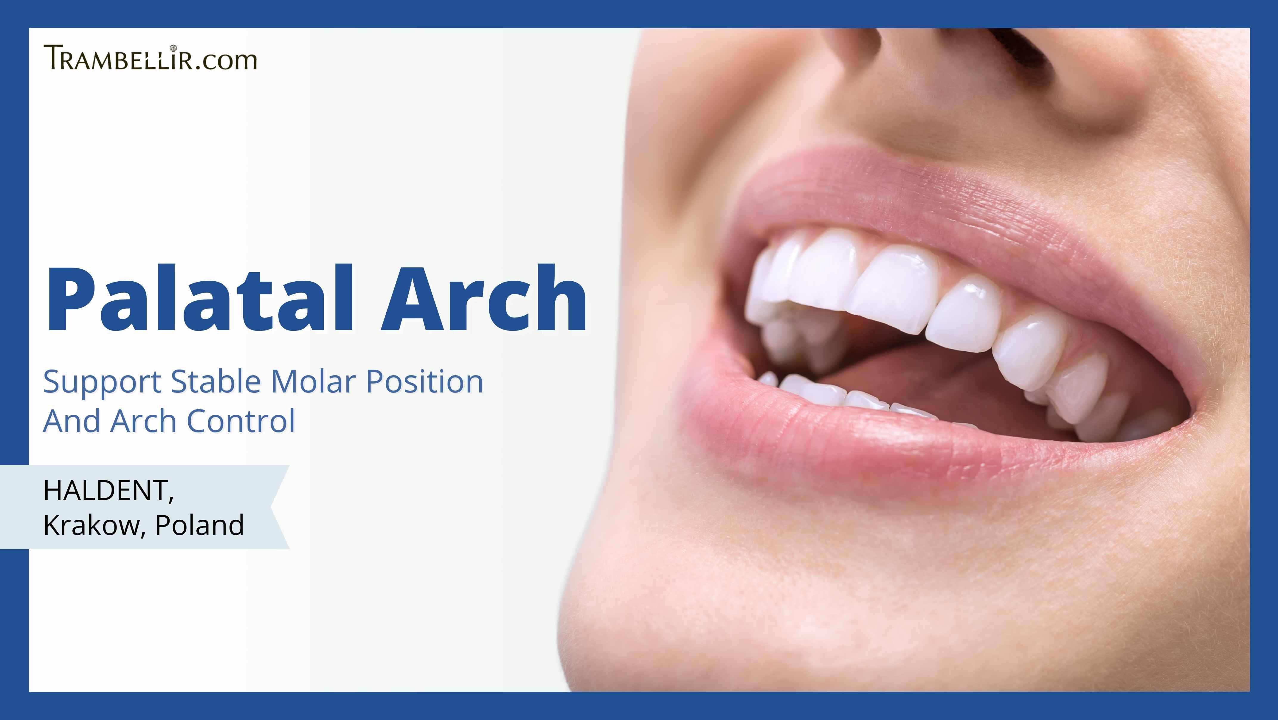 Palatal Arch (Support Stable Molar Position And Arch Control) | Trambellir