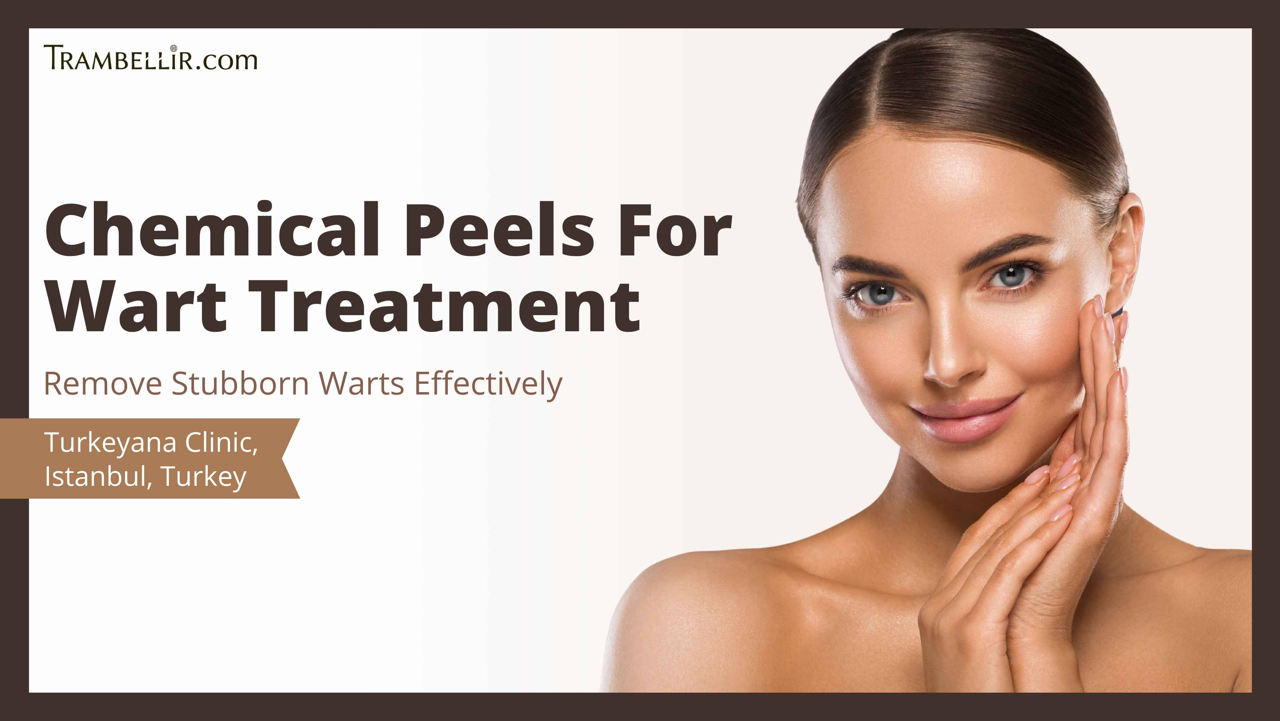 Chemical Peels For Wart Treatment (Remove Stubborn Warts Effectively ...